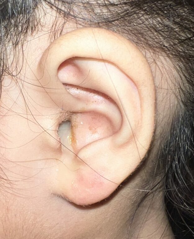 Screening questions – Learning on TAP