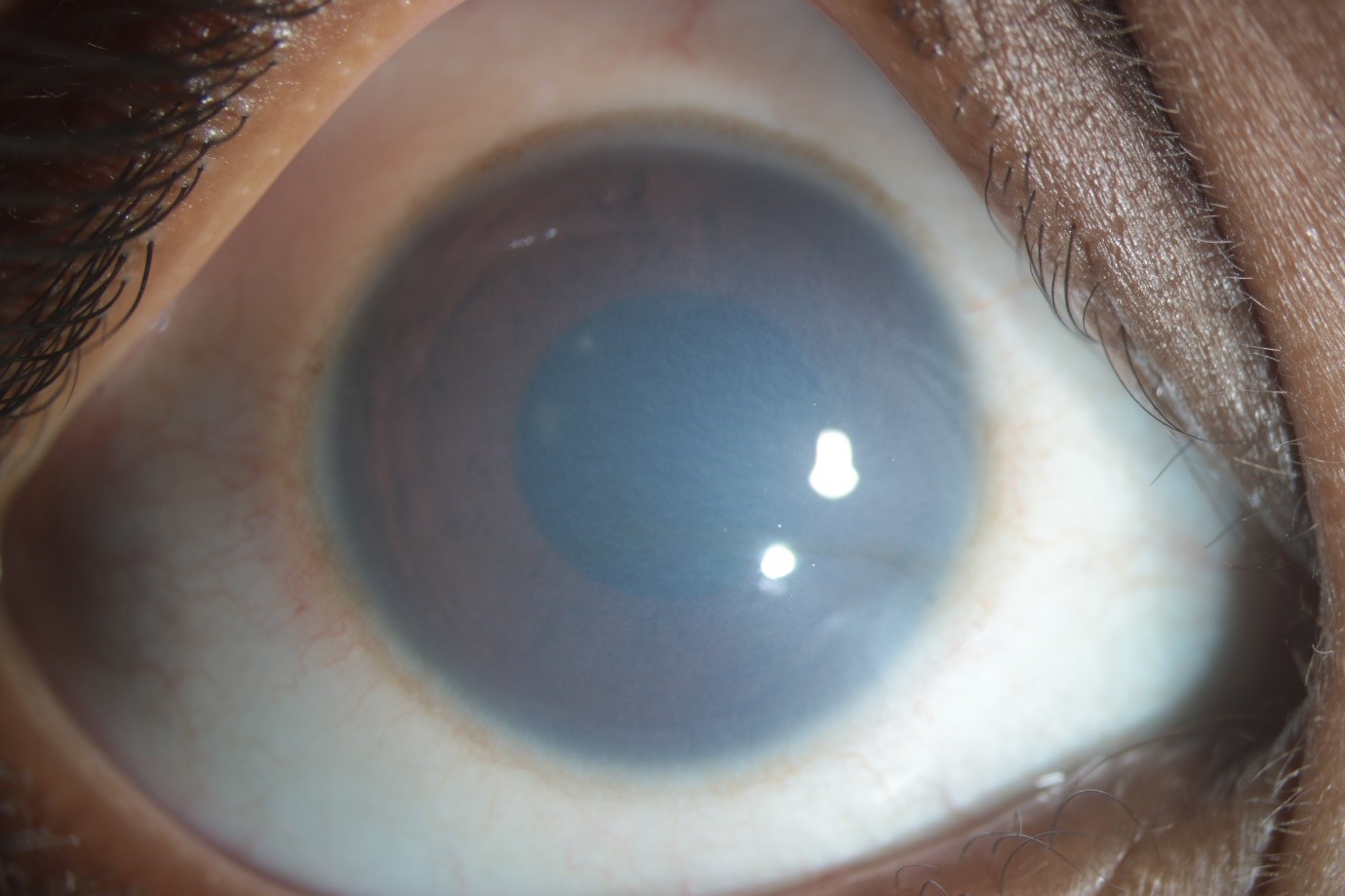 Signs of eye health problems – Learning on TAP
