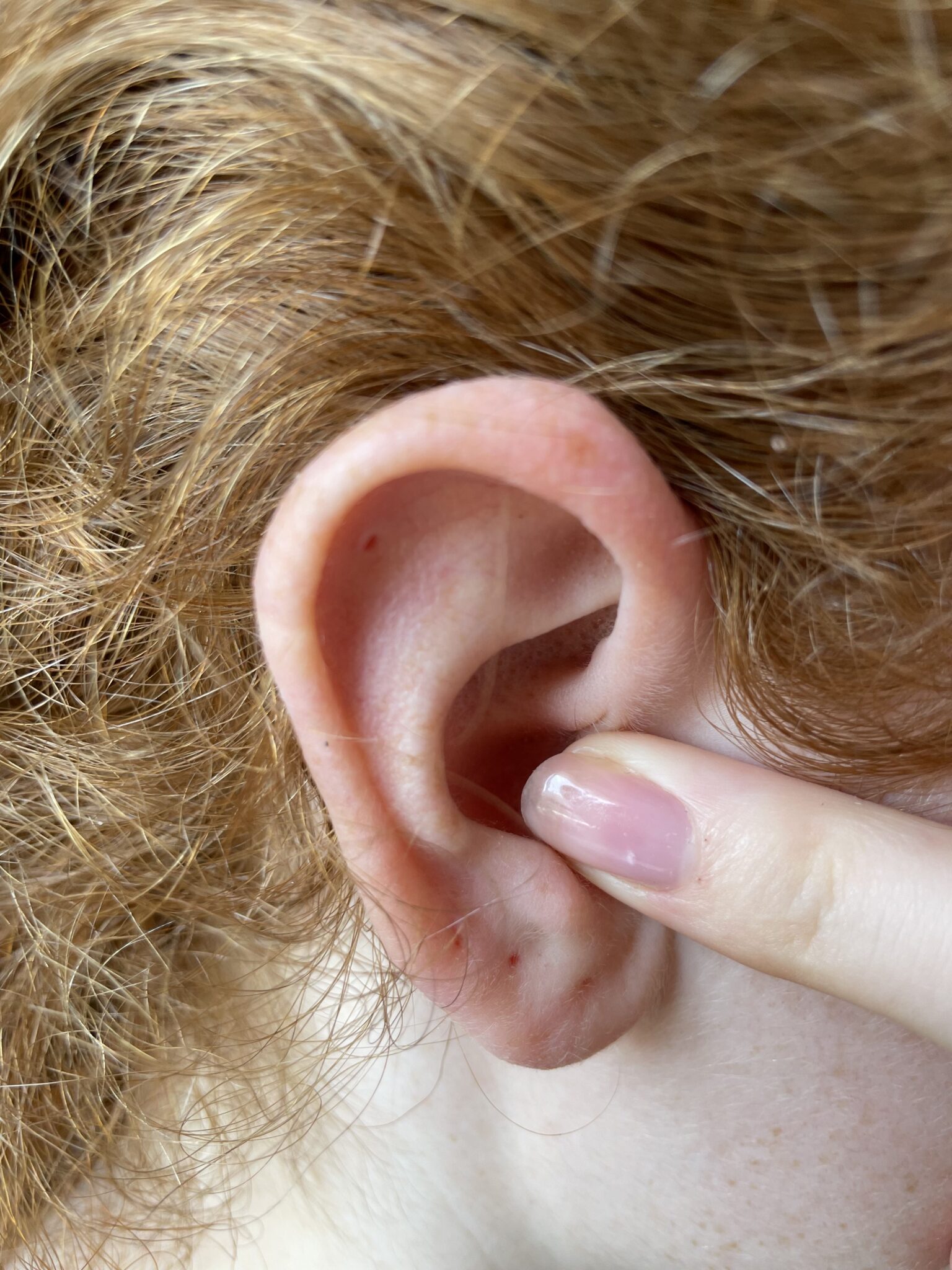 How to use an otoscope – Learning on TAP