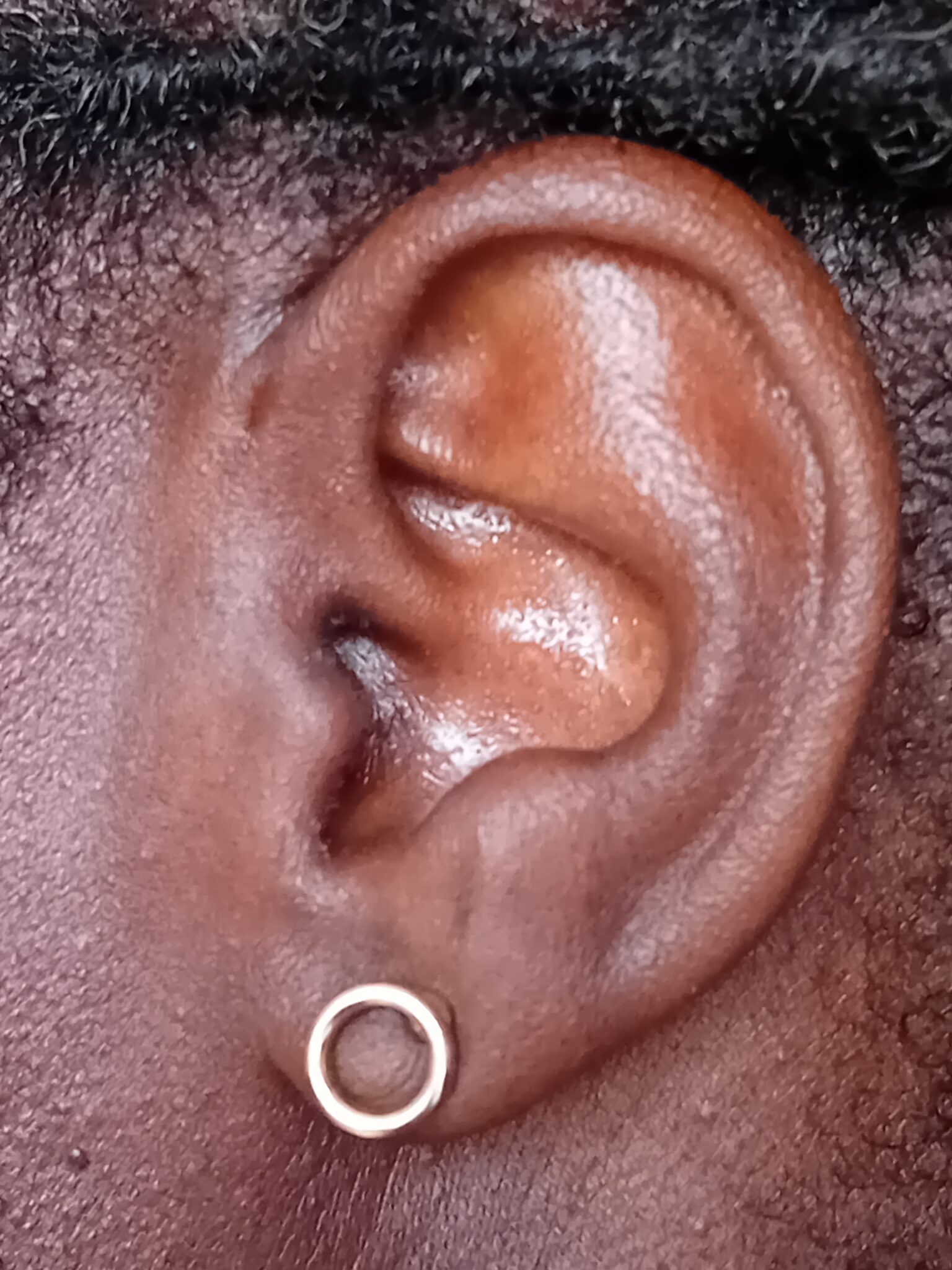 Ear health – Learning on TAP