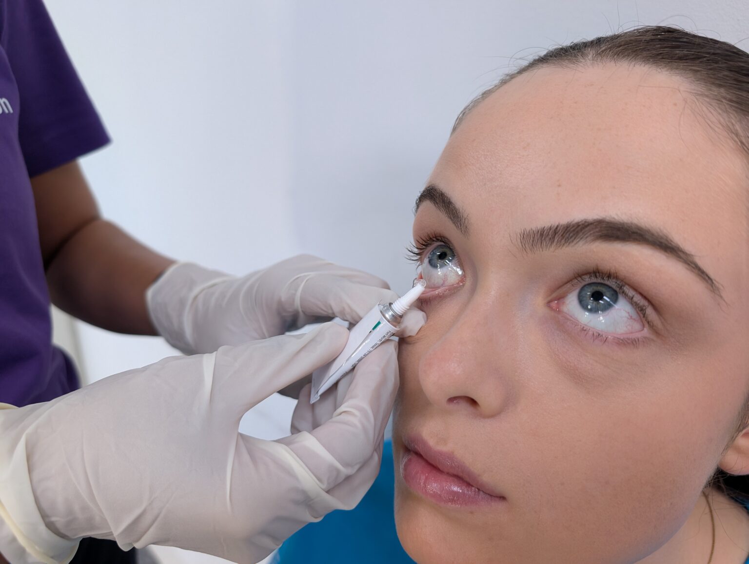 How to manage red eye problems – Training in Assistive Products